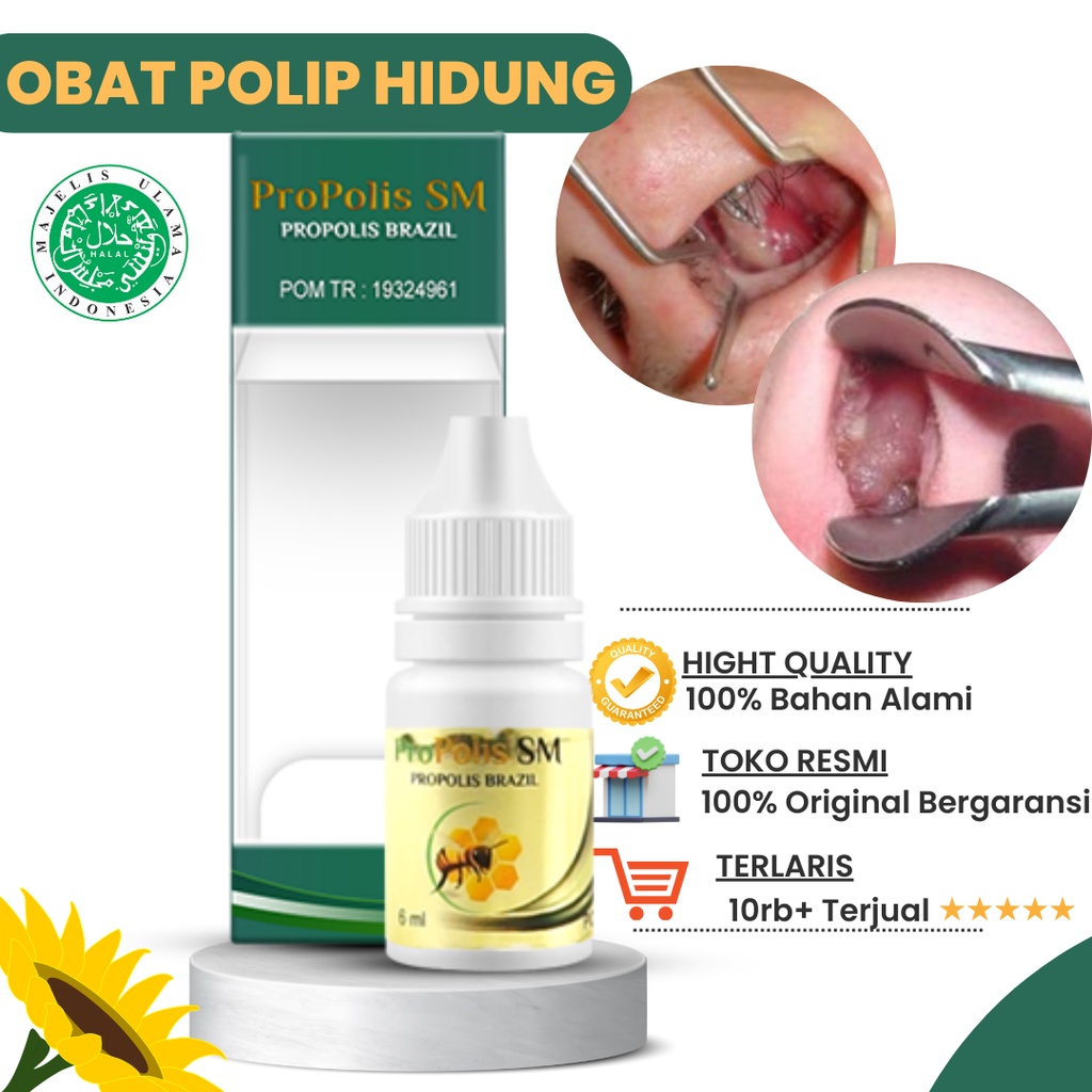 Jual Obat Tetes Polip hidung, Sinusitis Menahun, Sering keluar cairan ...