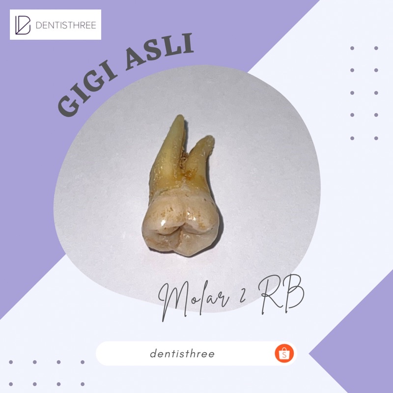 Jual Gigi Molar 2 Rahang Bawah | Shopee Indonesia