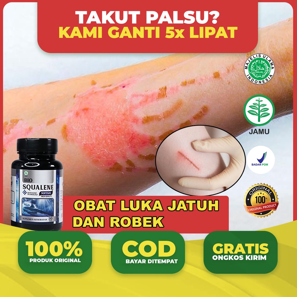 Jual Obat Luka Jatuh dan Robek - Luka Bernanah - Obat herbal Luka ...