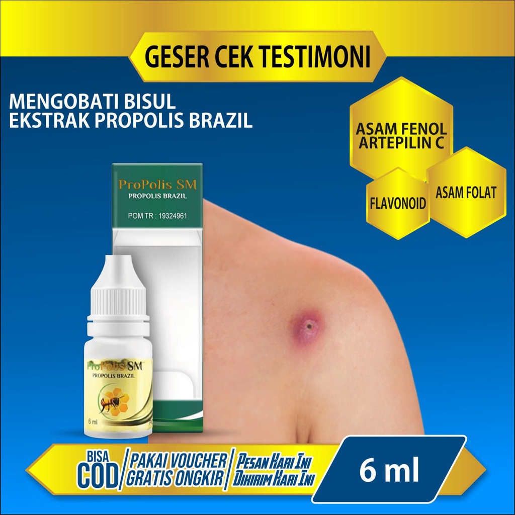 Jual Obat Bisul Bernanah Bisul di Telinga Wajah Leher Ketiak Pundak ... Jual Obat Bisul Bernanah Bisul di Telinga Wajah Leher Ketiak Pundak ...