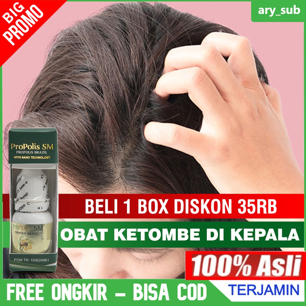 Jual Obat Ketombe Di Kepala - Ketombe Rambut - Ketombe Kulit Kepala Kering - Ketombe Akut ...