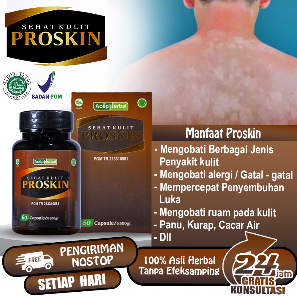 Jual Obat Panu Seluruh Badan Obat Panu di Wajah Bercak Putih di Kulit ...