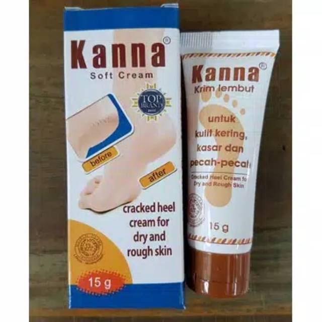 Jual KANNA SOFT CREAM / KANA KRIM LEMBUT UNTUK KAKI PECAH-PECAH ...
