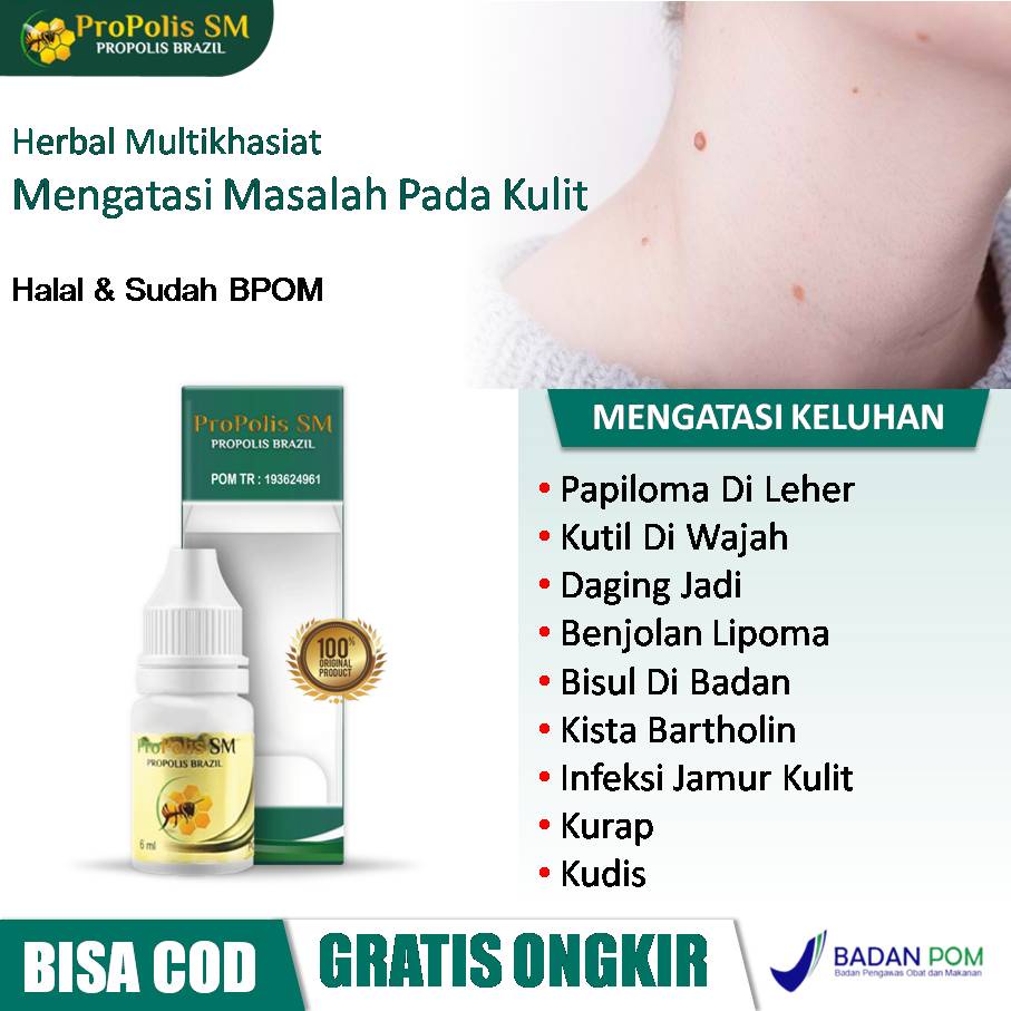 Jual Obat Papiloma Leher, Kutil Di Wajah, Benjolan Lipoma, Daging Jadi ...