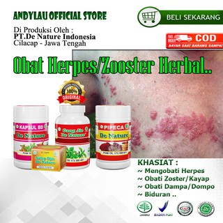 Jual Obat Zoster Herpes Kayap Dampa Dompo Cacar Ular Alergi Kulit ...