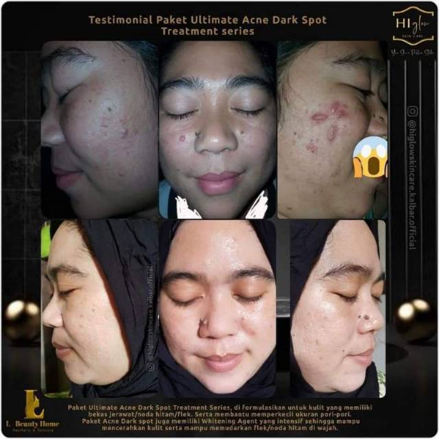 Produk Pusat HI Glow Skincare | Shopee Indonesia