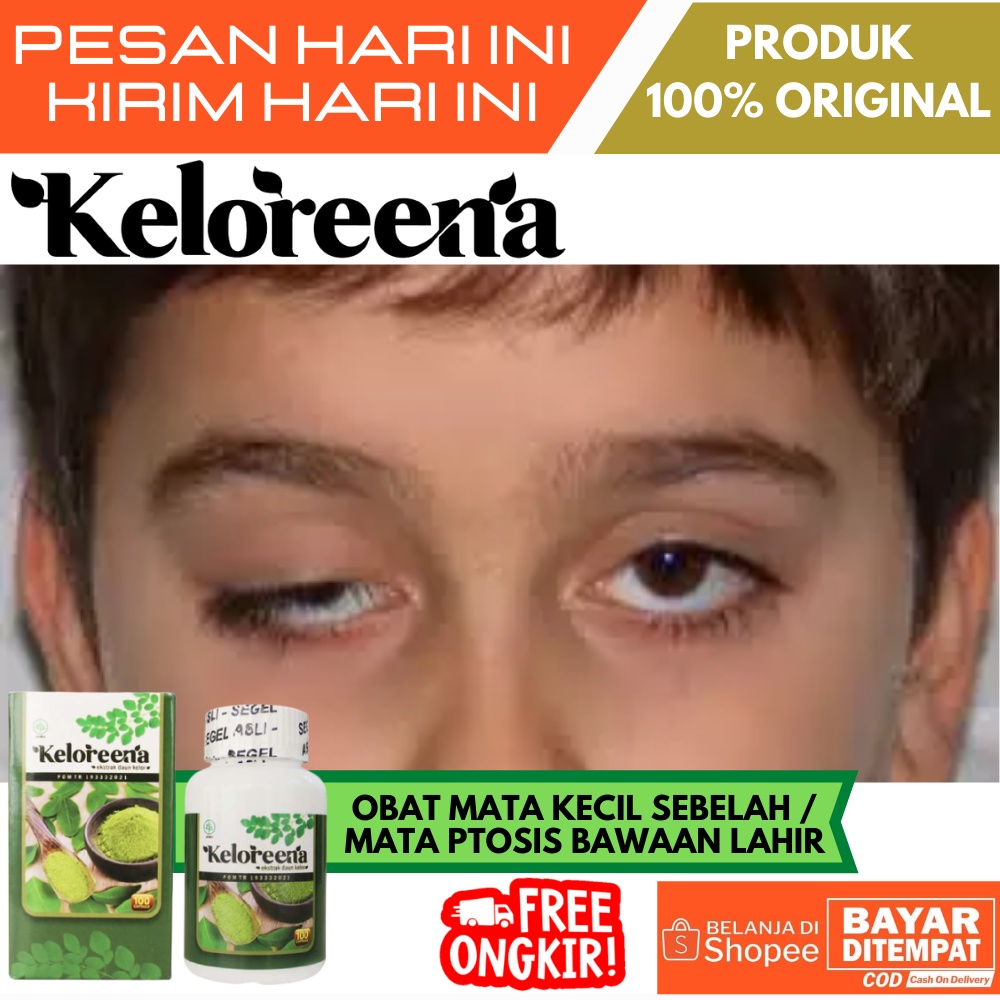 Jual Obat Saraf Mata Lemah, Rusak / Myasthenia Gravis / Miastenia ...