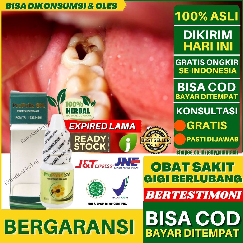 Jual Obat Sakit Gigi Berlubang Tak Kunjung Sembuh, Gusi Bengkak Bernanah, Gigi Linu, Gigi Ngilu ...