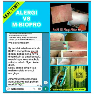 Jual Obat Cacar Air, Api, Bekas, Monyet, Ular, Anak & Dewasa Paling ...