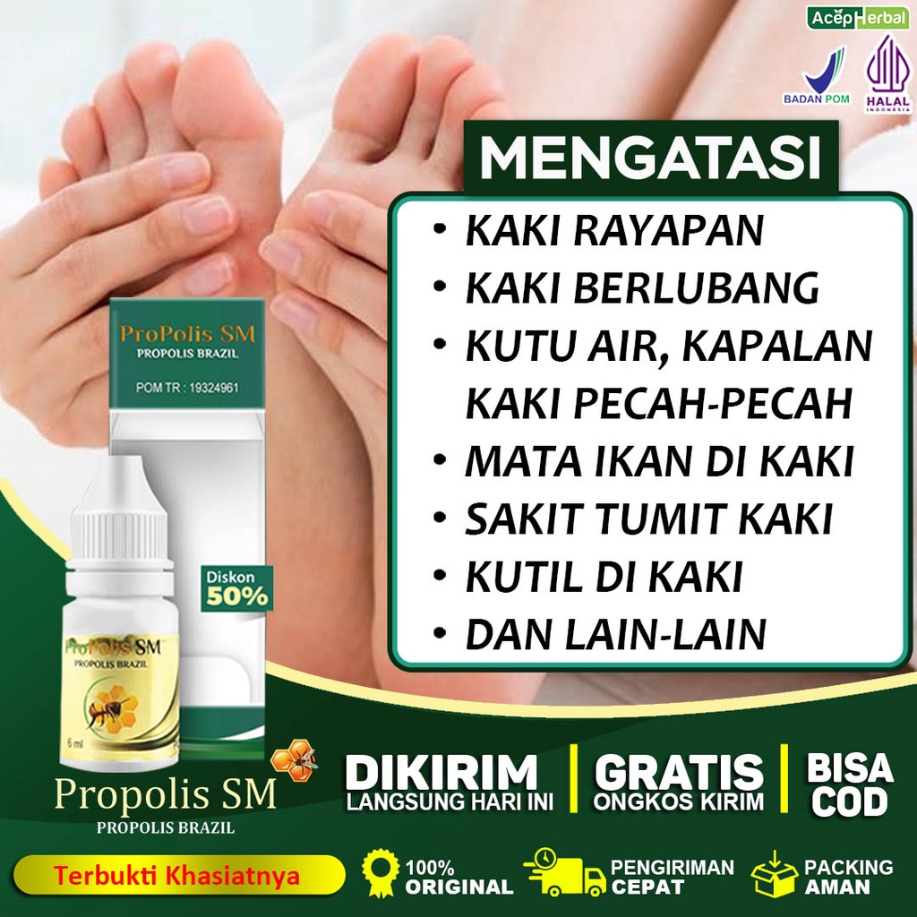 Jual Obat Kaki Rayapan Telapak Kaki Bolong-Bolong dan Bau Kutu Air ...
