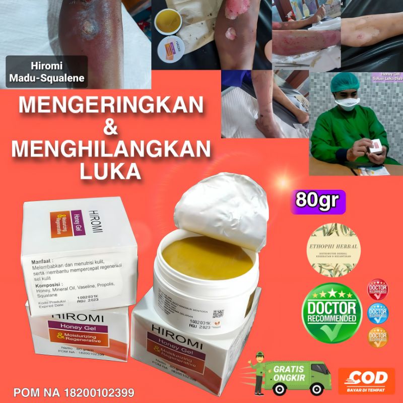 Jual Hiromi Salep Luka Bakar Koreng Diabetes Jahitan Pasca Operasi ...