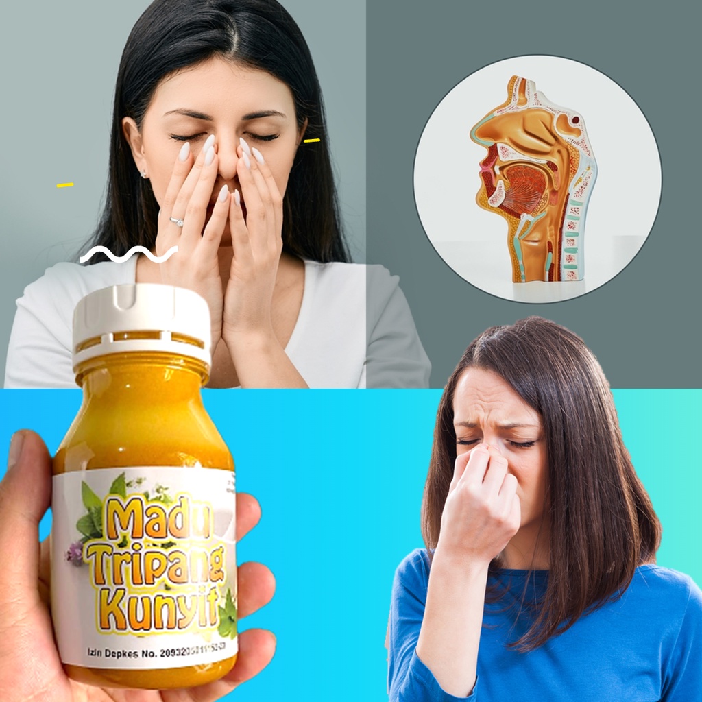 Jual Obat Sinusitis Apotik Terlengkap & Harga Terbaru Maret 2023 ...