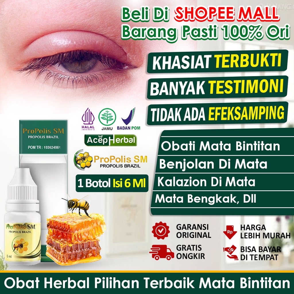 Jual Obat Mata Bintitan Mata Bengkak Penghilang Mata Bintilan Pengempis ...