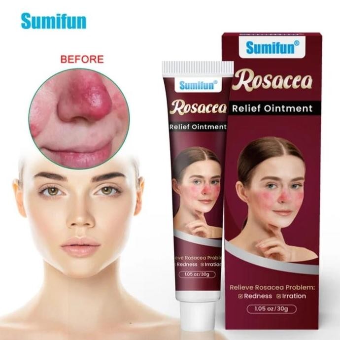Harga Krim Rosacea Terbaru Agt 2025 | BigGo Indonesia