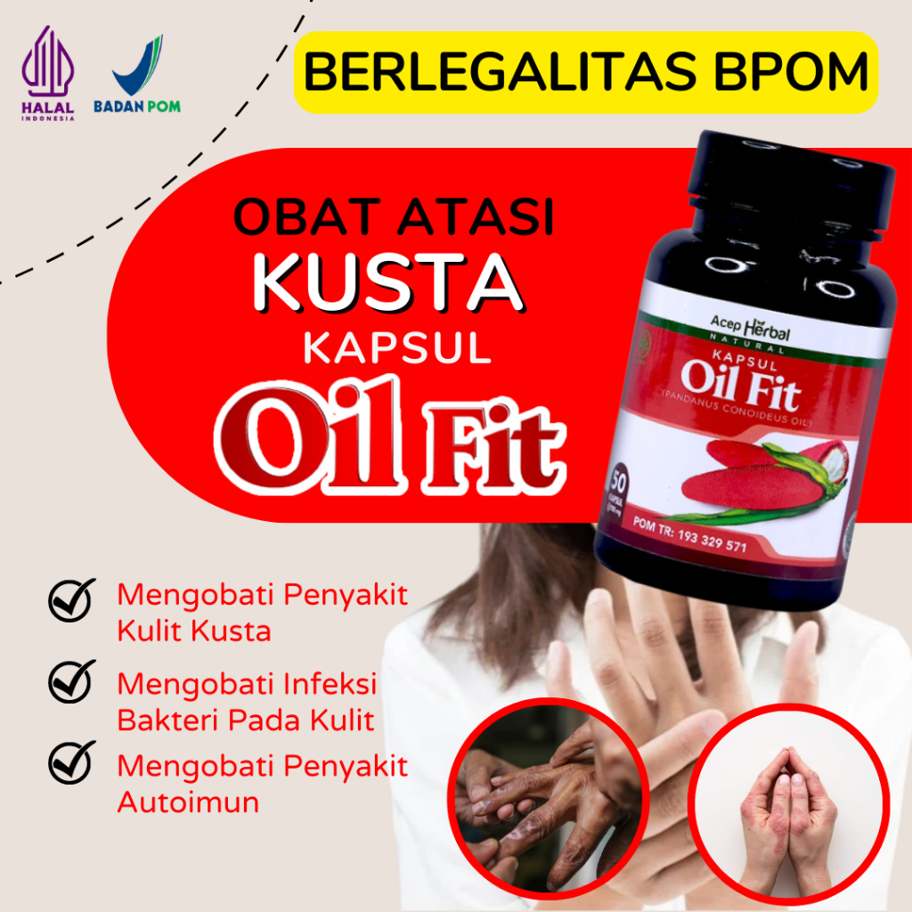 Jual Obat Kusta Lepra Penyakit Kulit Morbus Hansen Basah dan Kering ...