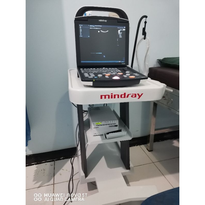 Jual mindray dp10 New version dengan printer | Shopee Indonesia