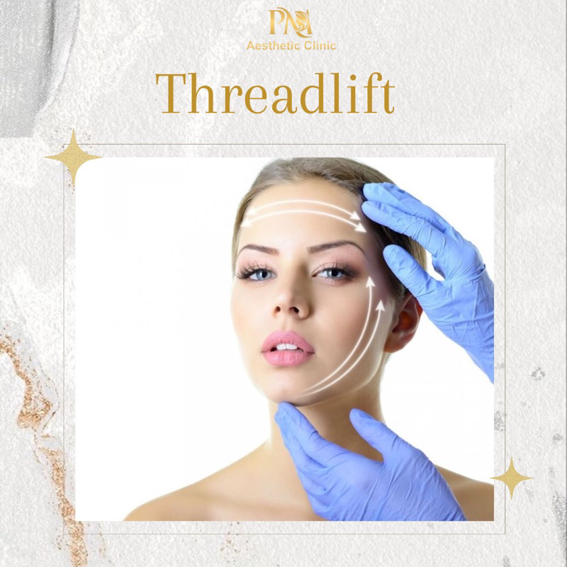 Harga Threadlift Terbaru Juni 2024 |BigGo Indonesia