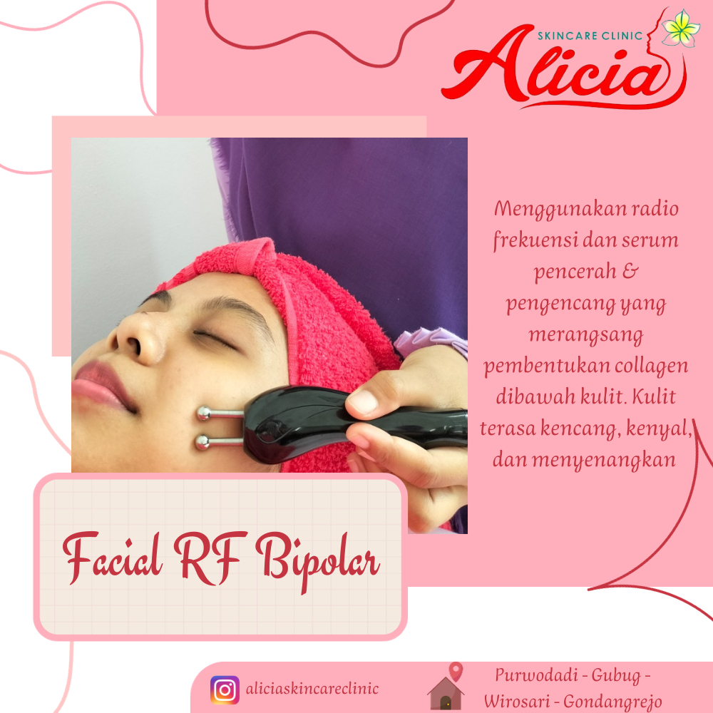 Harga rf bipolar Terbaru Jul 2025 | BigGo Indonesia