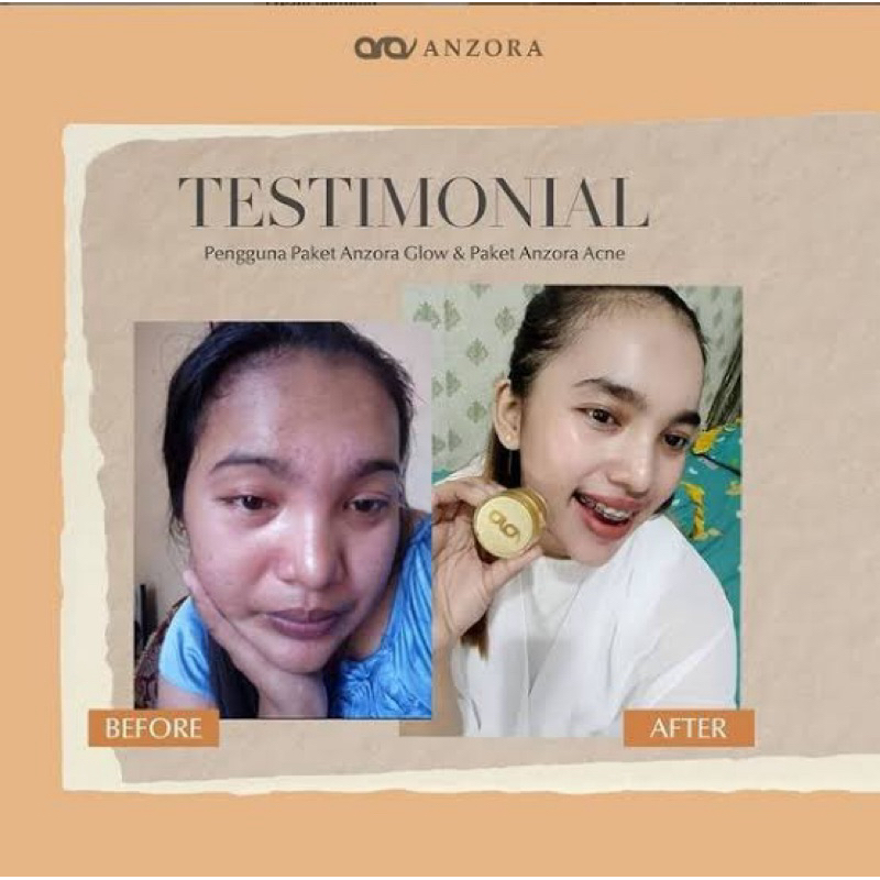 Harga Anzora Eceran Balikpapan Terbaru Jun 2025 | BigGo Indonesia