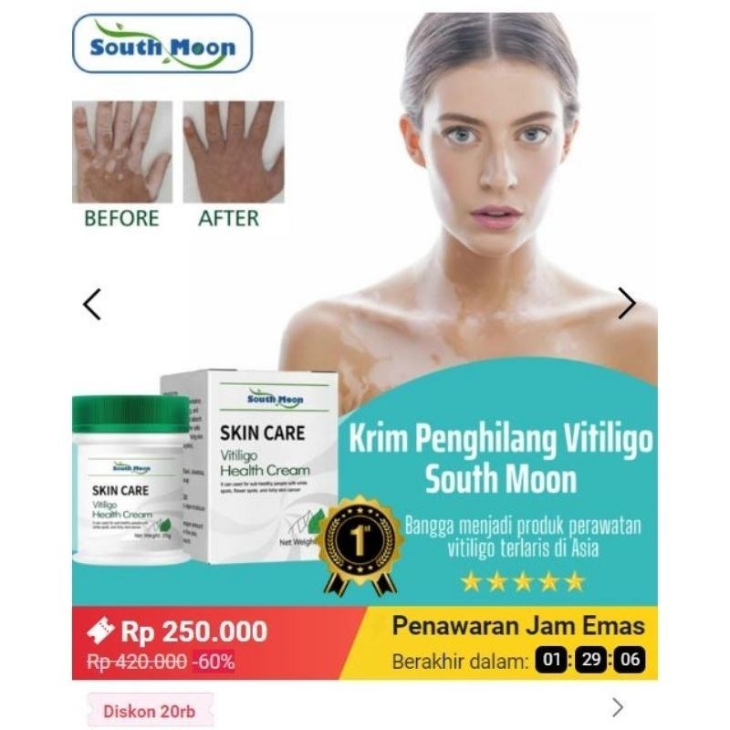 Harga Vitiligo Care Cream Terbaru Sep 2025 | BigGo Indonesia