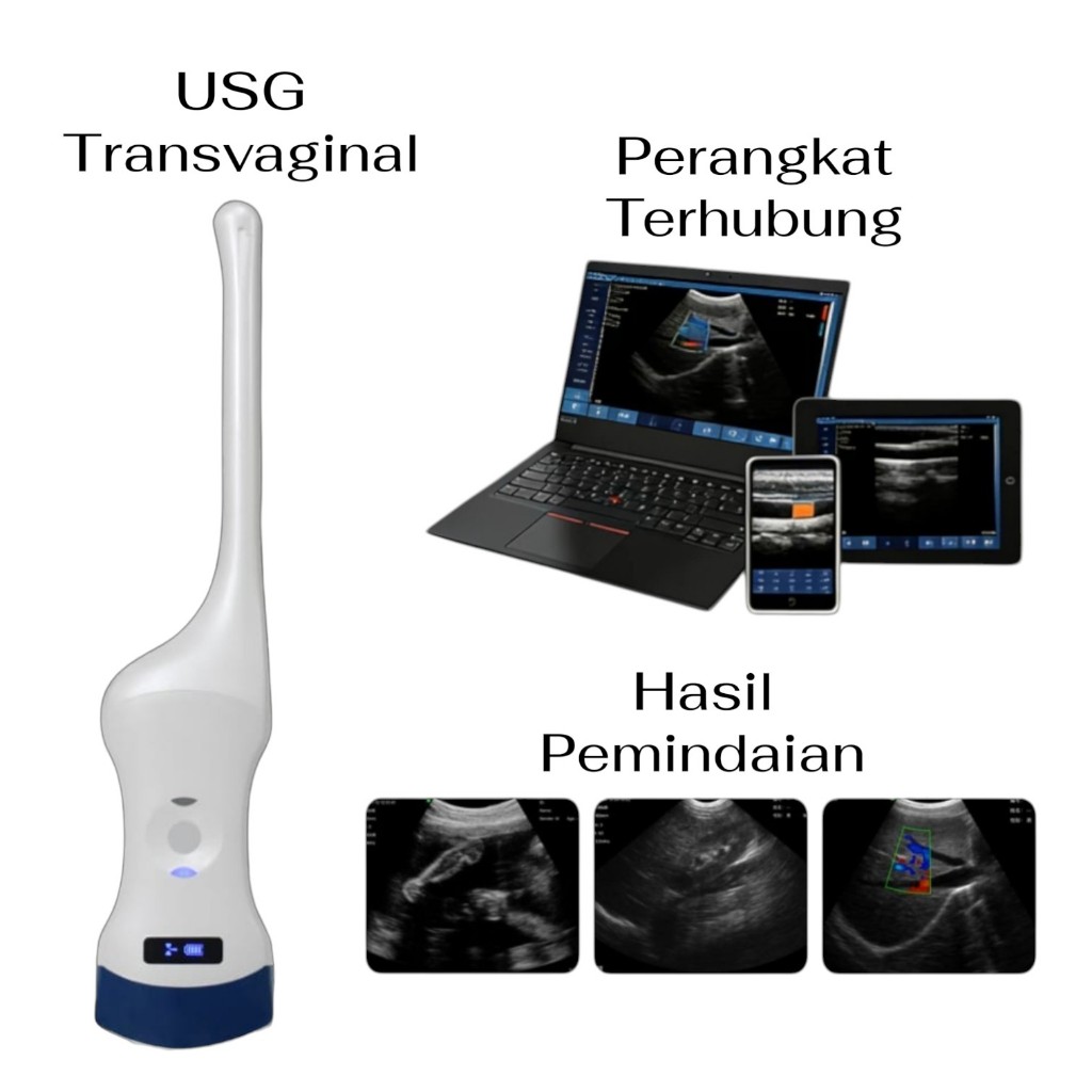 Harga Alat USG Transvaginal Terbaru Jun 2026 | BigGo Indonesia