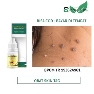 Jual Obat Skin Tag - Daging Jadi / Daging Tumbuh - Skin Tag Remover ...