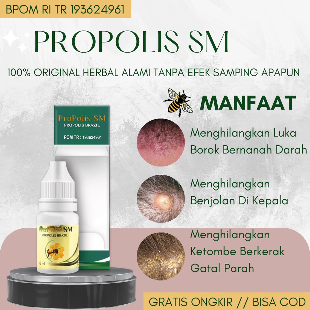 Jual Obat Borok Di Kulit Kepala - Obat Kepala Borok, Bersisik, Kering, Psoriasis, Kepala ...