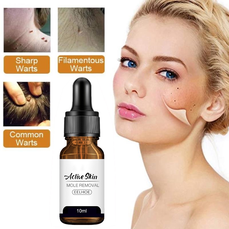 Jual Serum Penghilang Kutil Lotion Dan Tahi Lalat OIL Obat kutil di ...
