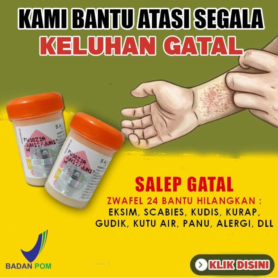 Jual Salep Zwafel 24 original Obat gatal panu kadas kurap kutu air ...