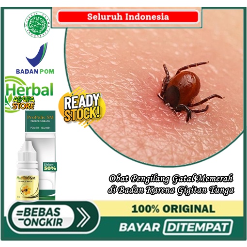 Jual Obat Penghilang Gatal Memerah di Badan Karena Gigitan Tungau ...