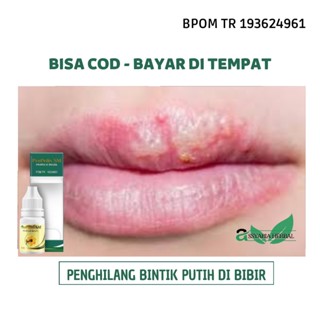Jual Obat Penghilang Bintik Putih di Bibir, Obat Oles Benjolan Kecil ...