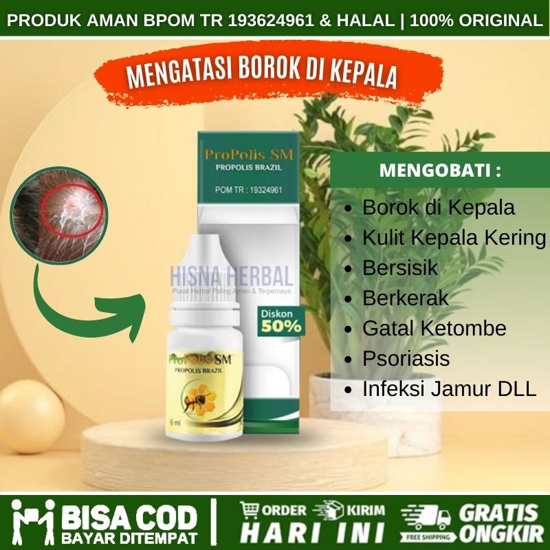 Jual OBAT BOROK DI KULIT KEPALA, PENGERING LUKA BOROK, KULIT KEPALA KERING, MENGHILANGKAN KULIT ...