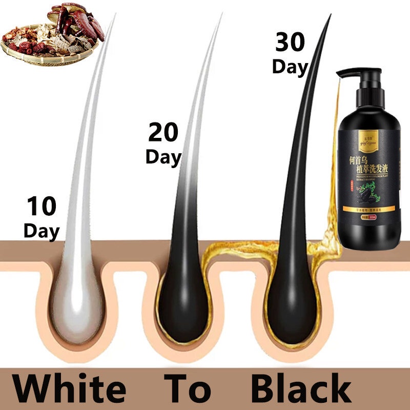 Jual Shampo penumbuh rambut Sampo anti ketombe Shampo rambut rontok ...