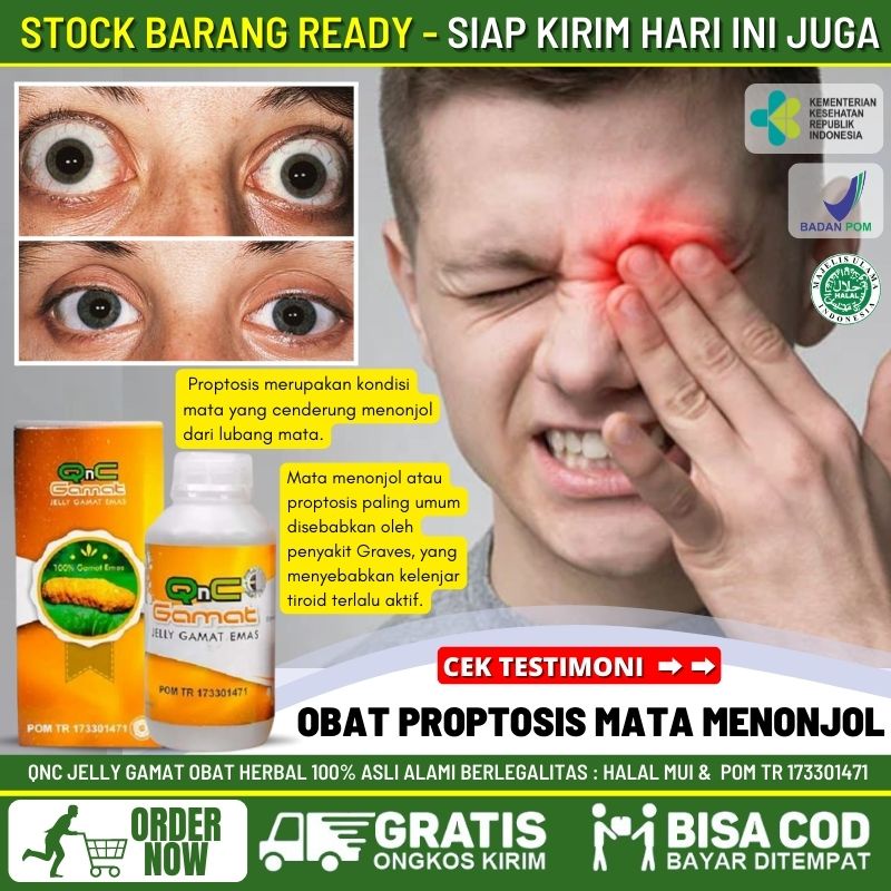 Jual Obat Herbal Mata Menonjol Keluar Akibat Tiroid, Obat Mata Bengkak ...