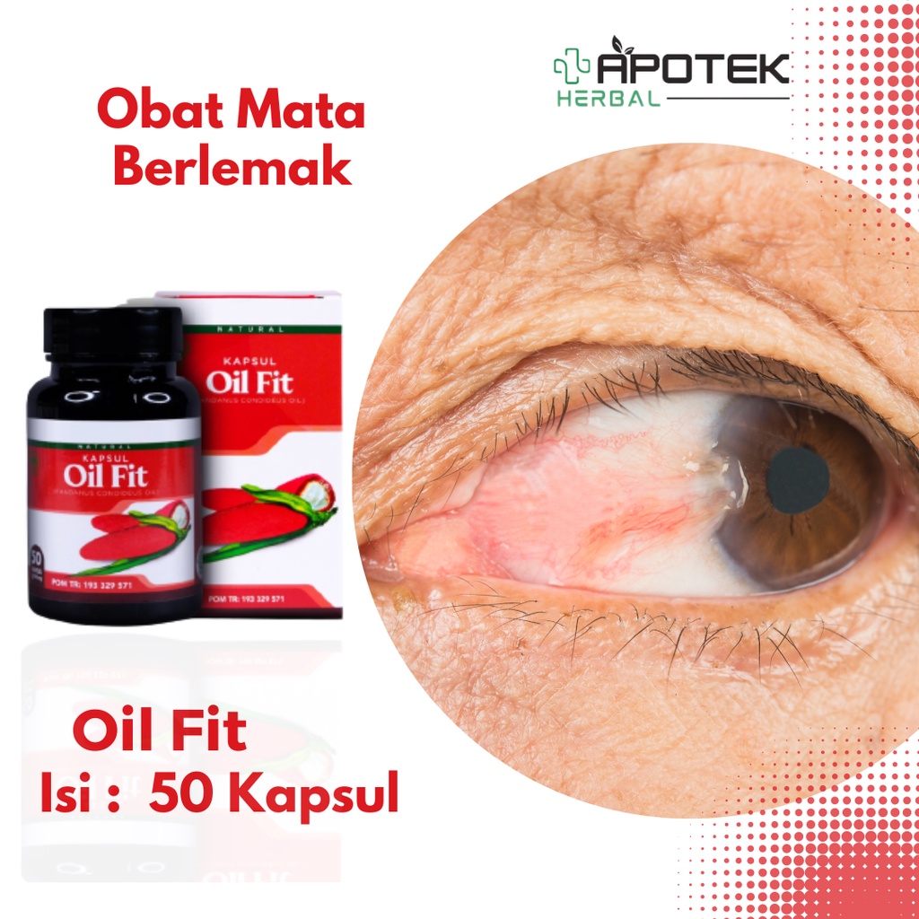 Jual Obat Mata Berlemak, Mata Pterigium, Mata Berlemak Kekuningan, Glukoma, Selaput di Bagian ...