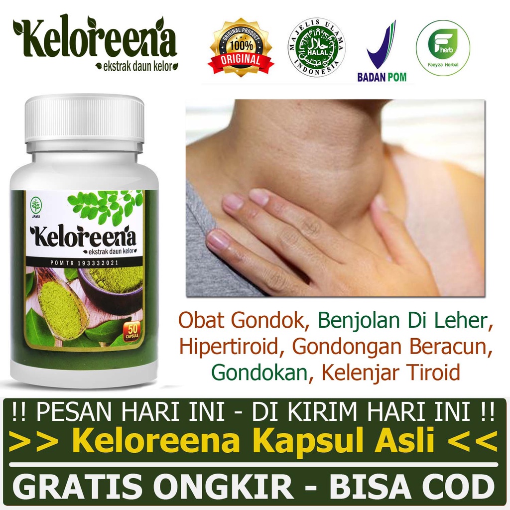 Jual Obat Gondok Benjolan Di Leher Hipertiroid Gondongan Beracun ...