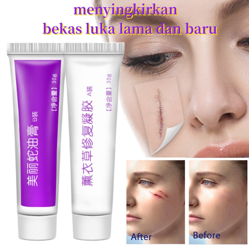 Jual Krim bekas luka Penghilang bekas luka Ekstrak tumbuhan salep luka ...