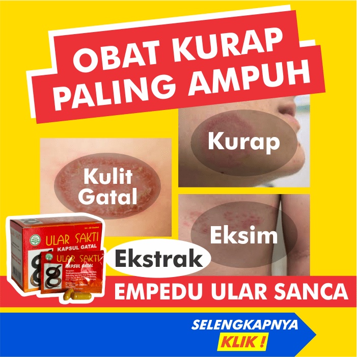Jual Obat Kurap Kudis Paling Ampuh Gatal Kulit Gatel Kadas Eksim Kering ...