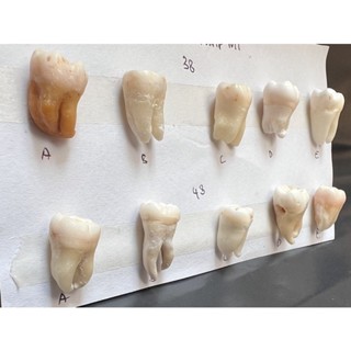 Jual Gigi molar rahang bawah m3 mirip m1 | Shopee Indonesia