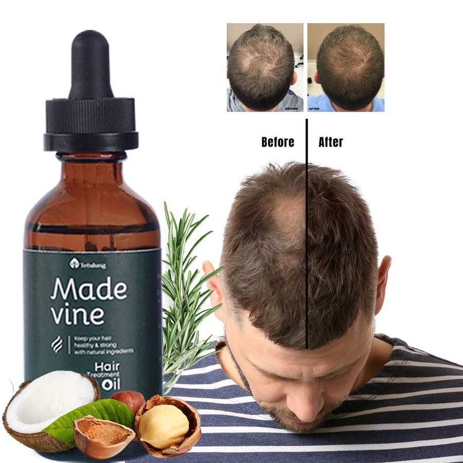 Jual MADEVINE HAIR OIL 60ML - Serum Perawatan Rambut Rontok dan ...