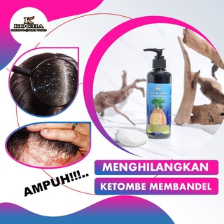 Jual shampo shampoo sampo anti ketombe dan rambut rontok paling ampuh | Shopee Indonesia