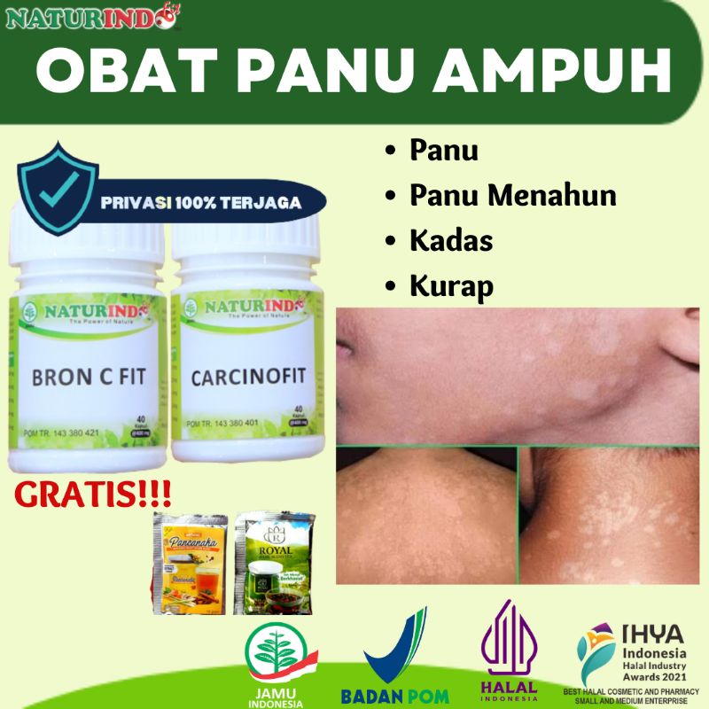 Jual Obat Penghilang Panu Kadas Kurap Menahun Kudis Exsim Panuan ...