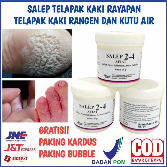 Jual SALEP TELAPAK KAKI RAYAPAN TELAPAK KAKI RANGEN DAN KUTU AIR ...