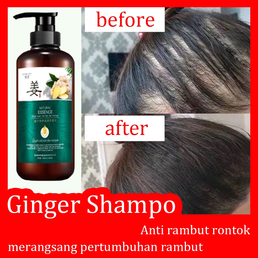 Jual sampo anti-rambut rontok /sampo anti ketombe kontrol minyak Shampo ...