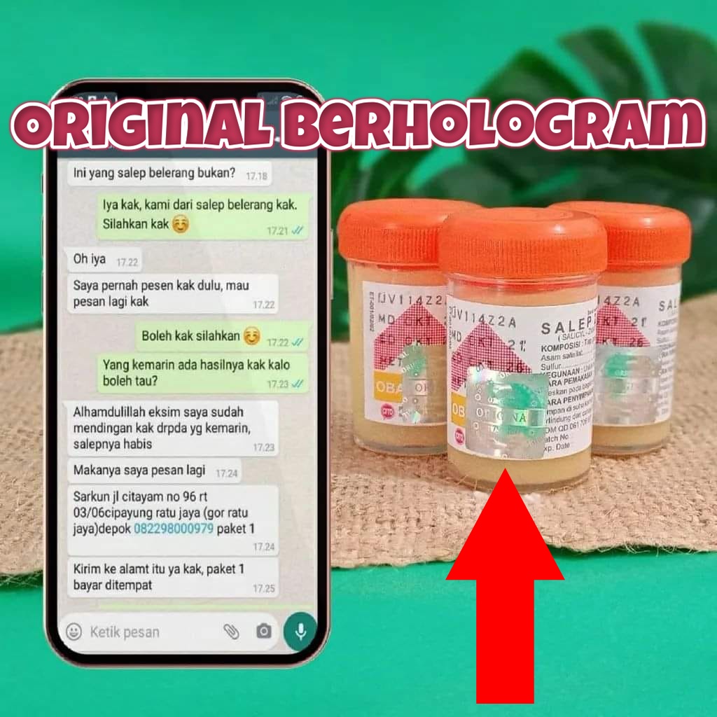 Jual Salep Zwafel 24 Asli Original Gatal Scabies - Salep Gatal 2-4 Cito ...