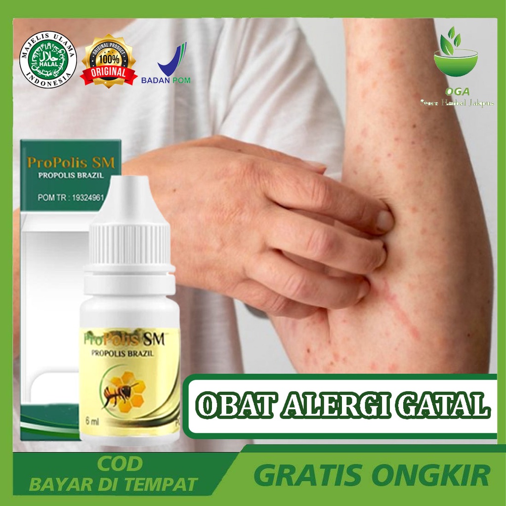 Jual SALEP OBAT UNTUK ALERGI GATAL JAMURAN JERAWAT EKSIM PSOARISIS ...