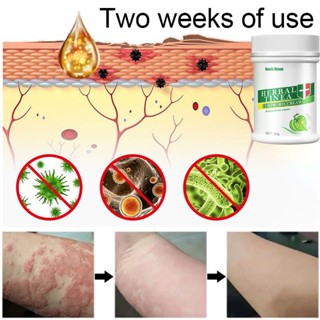 Jual Salep gatal Salep Eksim Salep kulit Krim psoriasis paling ampuh ...