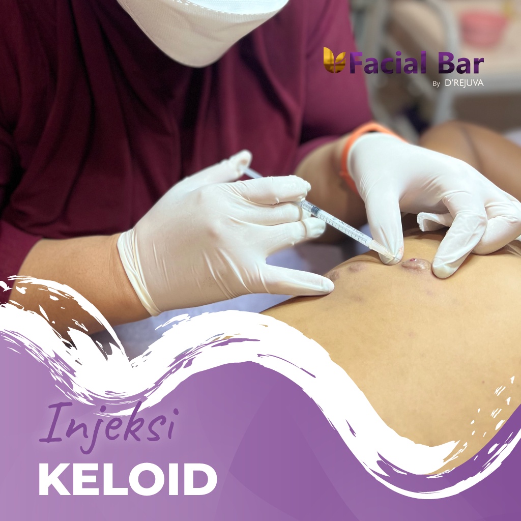 Harga keloid injeksi Terbaru Mar 2025 | BigGo Indonesia