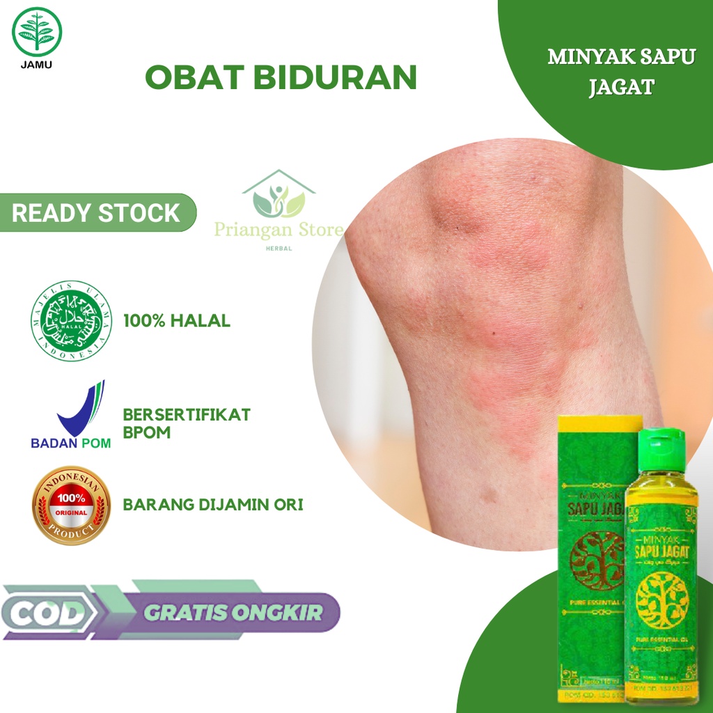 Jual Obat Biduran, Obat Alergi, Gatal Gatal Kulit, Alergi Dingin ... Jual Obat Biduran, Obat Alergi, Gatal Gatal Kulit, Alergi Dingin ...