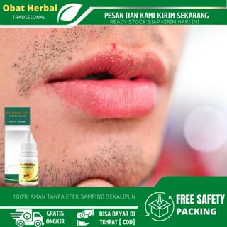 Jual Obat Bintik Putih di Bibir, Bercak Putih di Sekitar Bibir, Luka ...